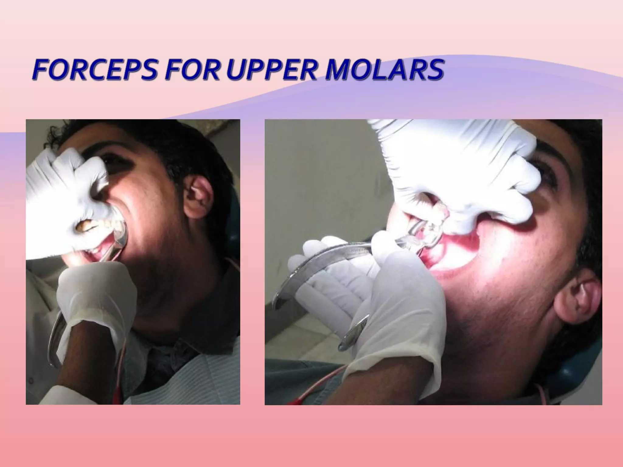 oral surgery instruments | PPS