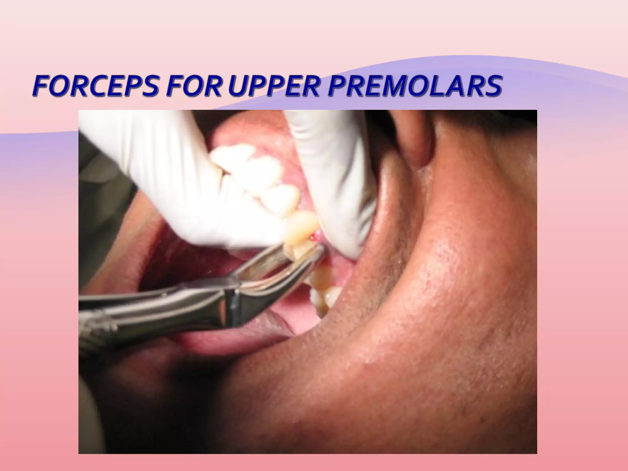 oral surgery instruments | PPS