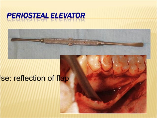 oral surgery instruments | PPS | Dental Health | Diseases and Conditions