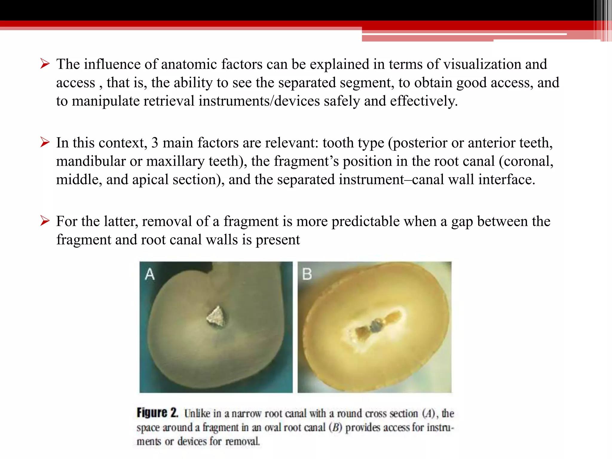 Instrument seperation and its management | PPTX