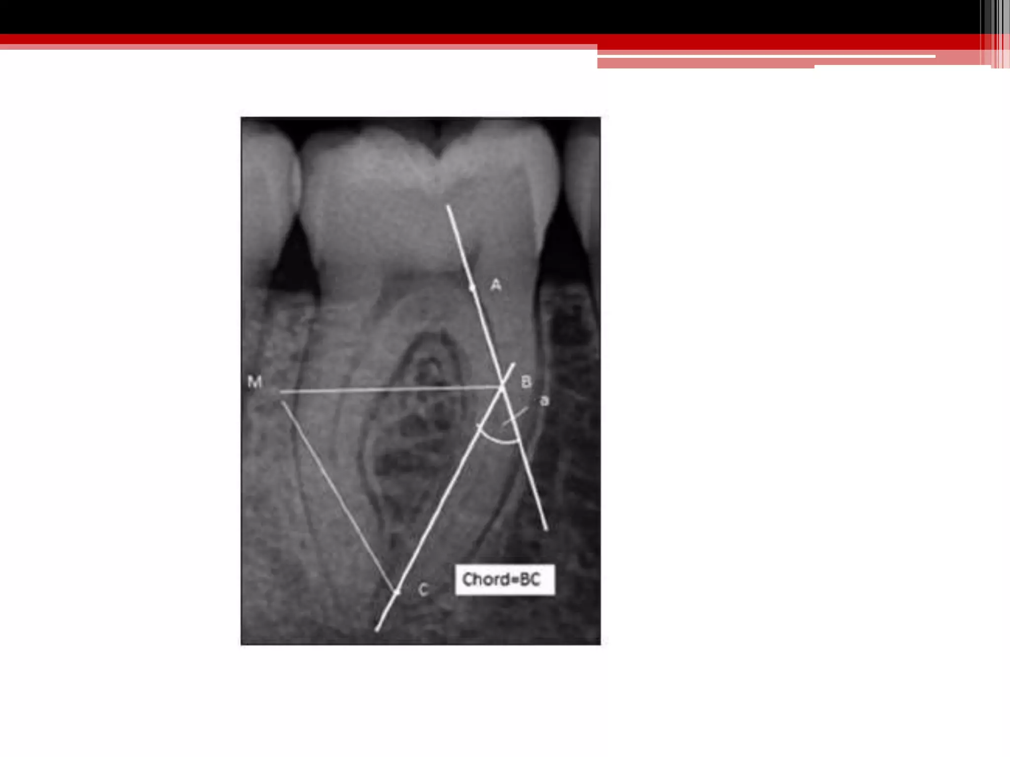 Instrument seperation and its management | PPTX