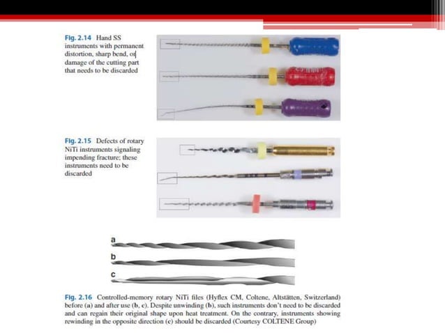 Instrument seperation and its management | PPTX | Dental Health ...