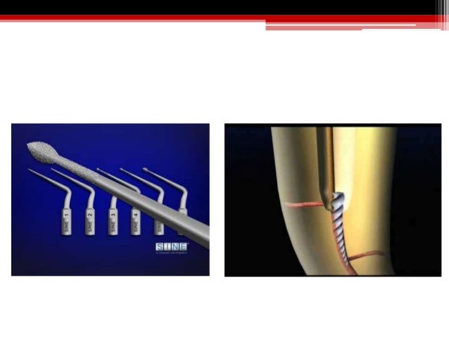 Instrument seperation and its management