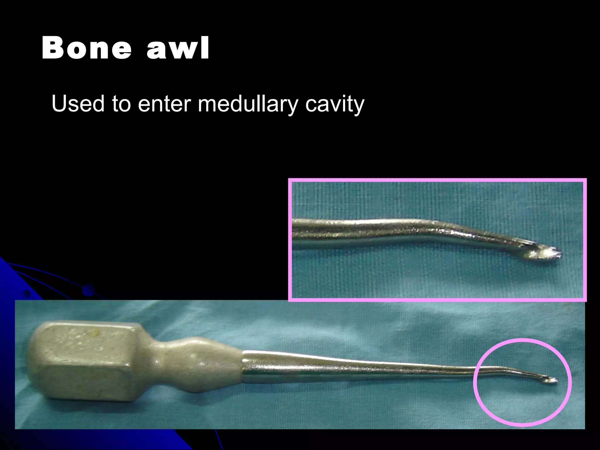 Instruments & implants | PPT