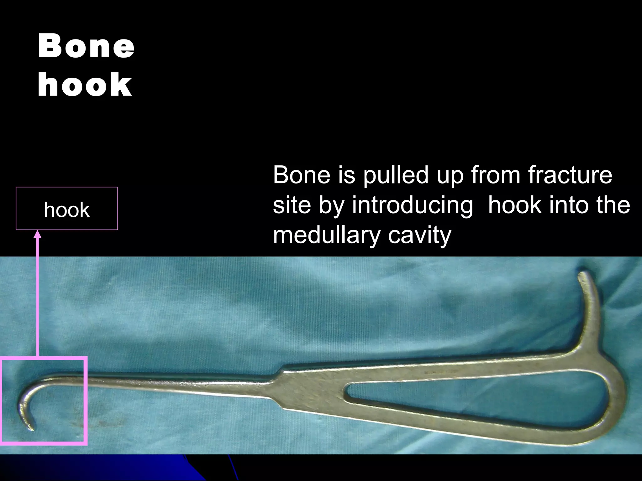 Instruments & implants | PPT
