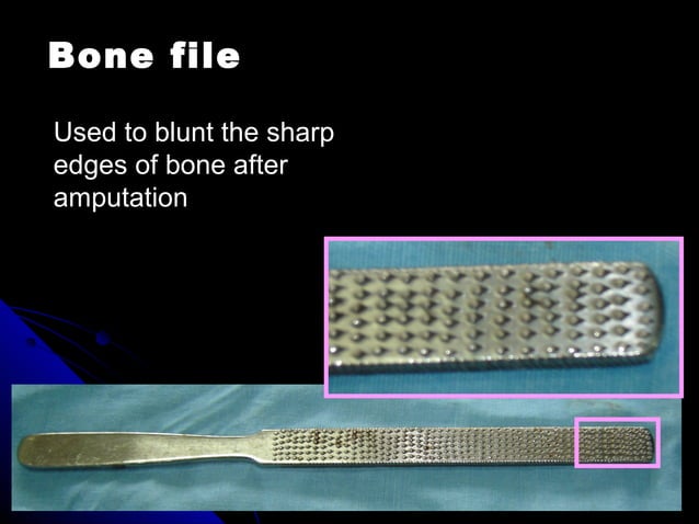 Instruments & implants | PPT | Death, Injury, or Military Conflict | Sensitive Topics