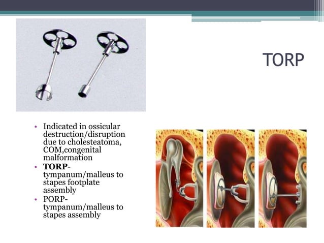Instruments in ent..aak | Ear, Nose and Throat Conditions | Diseases ...
