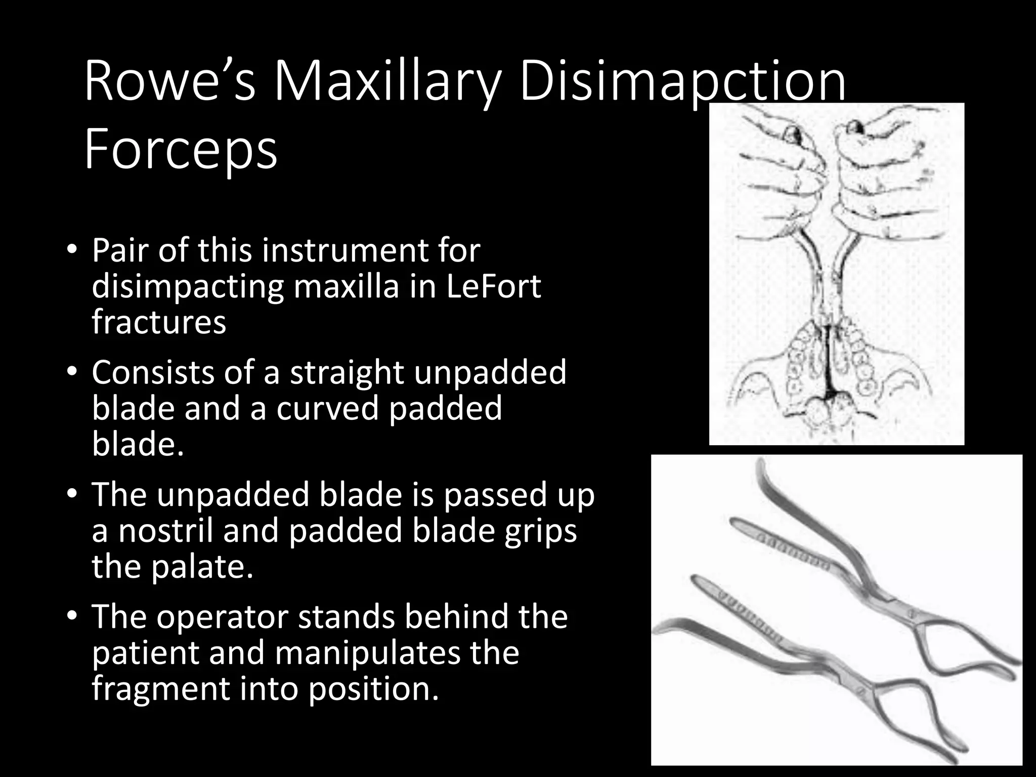 Instruments in major oral and maxillofacial surgery | PPTX