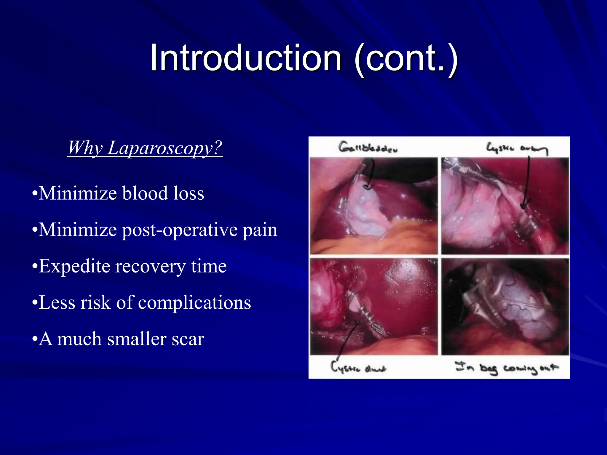Instruments used in Laparoscopic surgery.pptx | Surgery | Medical Health