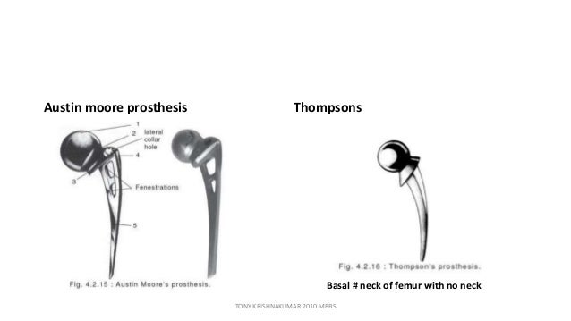 Instruments orthopaedics for mbbs students