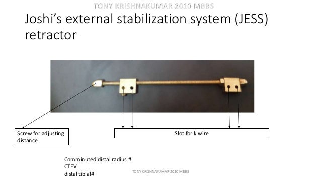 Instruments orthopaedics for mbbs students