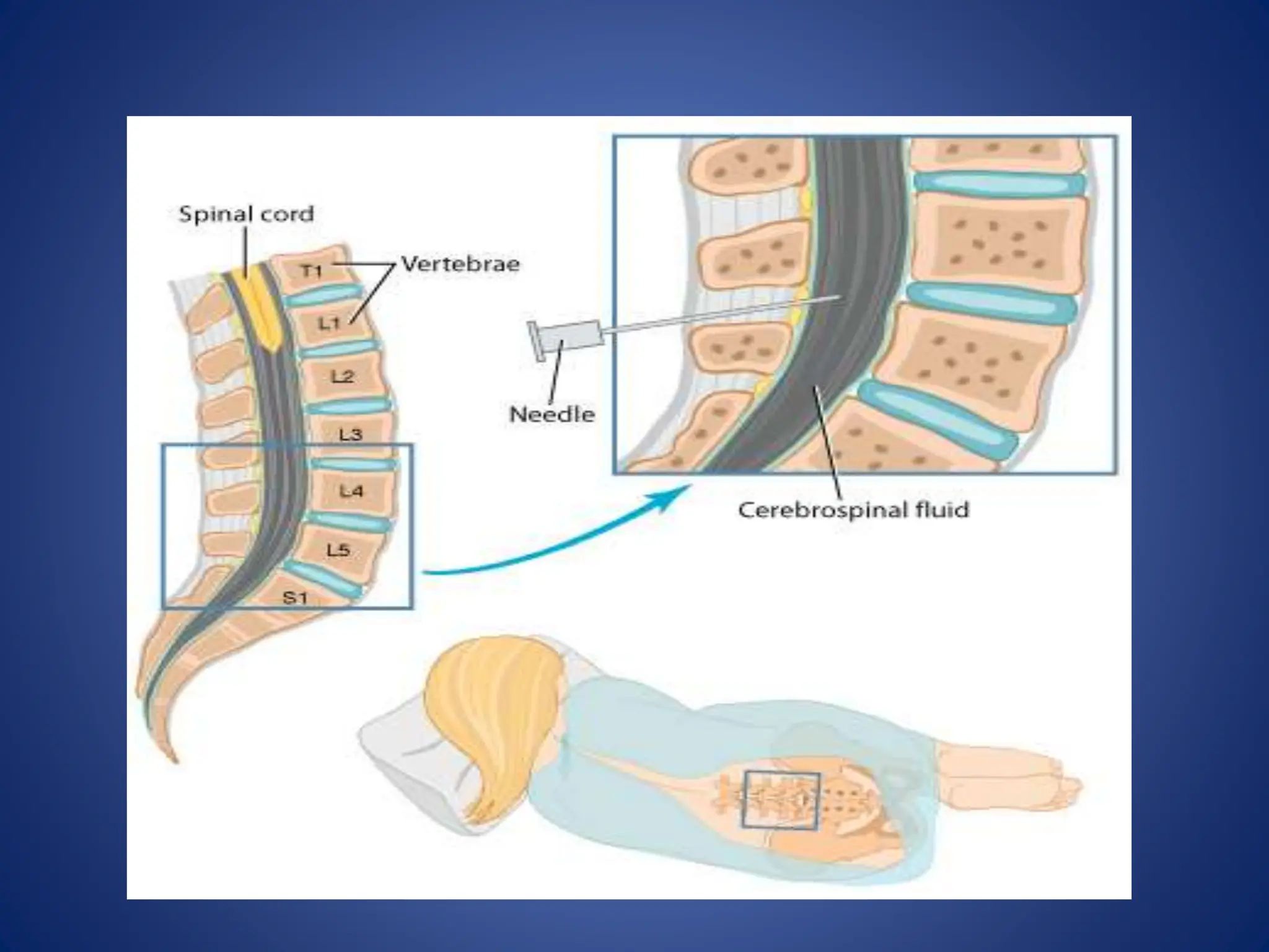INSTRUMENTS POWERPOINT for final year mbbs students.pptx