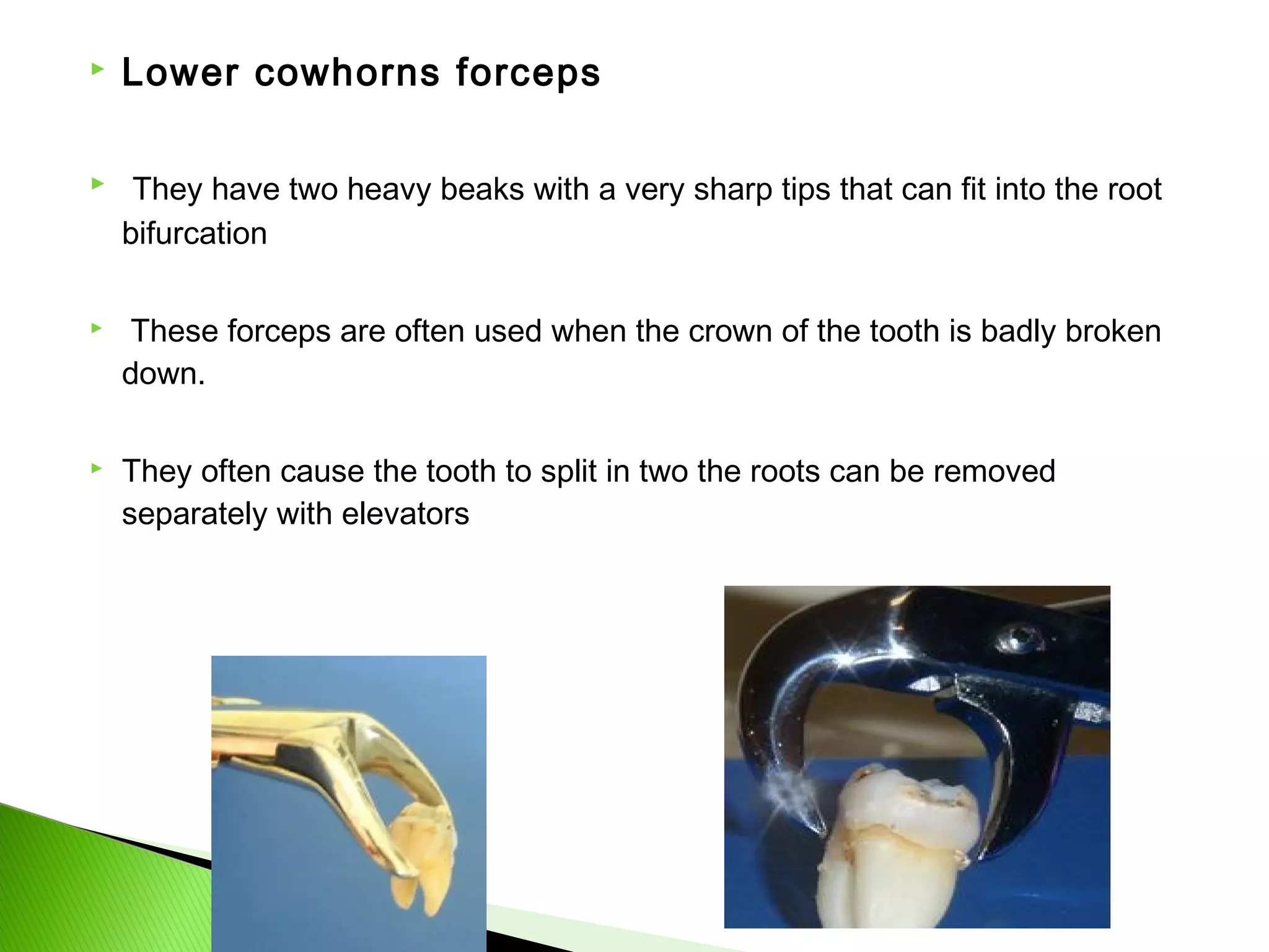 Instrument used in exodontia (updated) | PPT