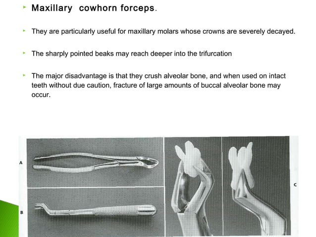 Instrument used in exodontia (updated) | PPT | Dental Health | Diseases ...