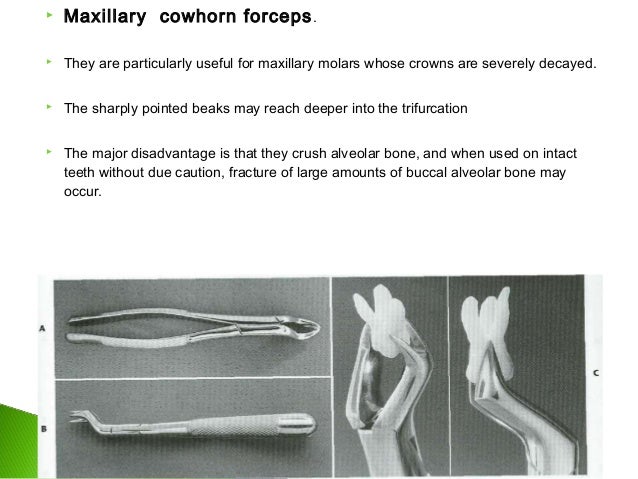 Instrument used in exodontia (updated)