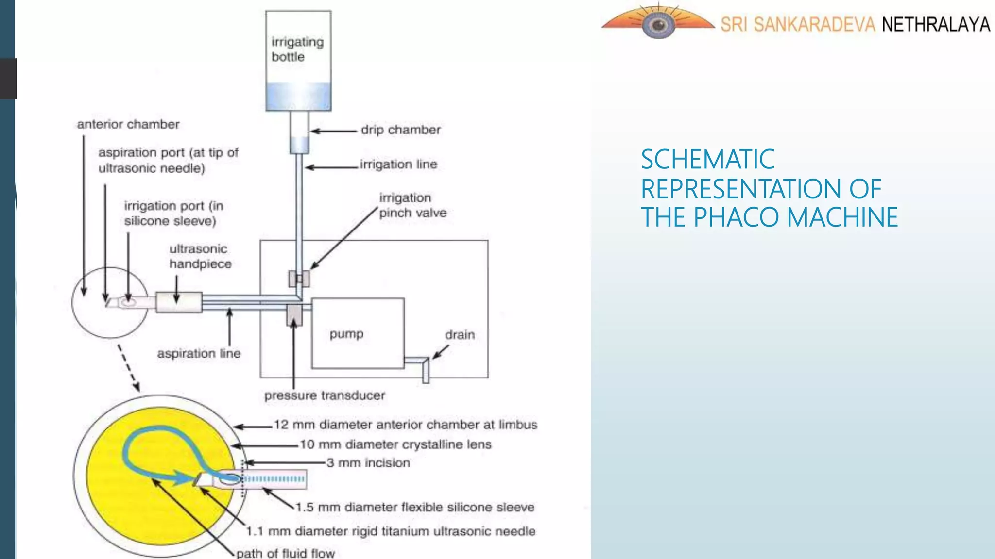 Instumentation and machines in phacoemulsification | PPTX