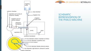 Instumentation and machines in phacoemulsification | PPT