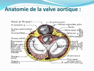 Insuffisance aortique | PPT