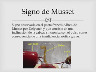 Insuficiencia aortica signos | PPTX
