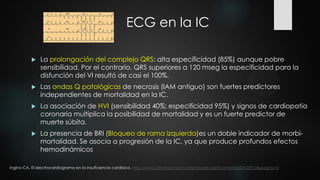 Insuficiencia cardíaca | PPTX