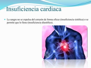 Insuficiencia cardiaca | PPTX