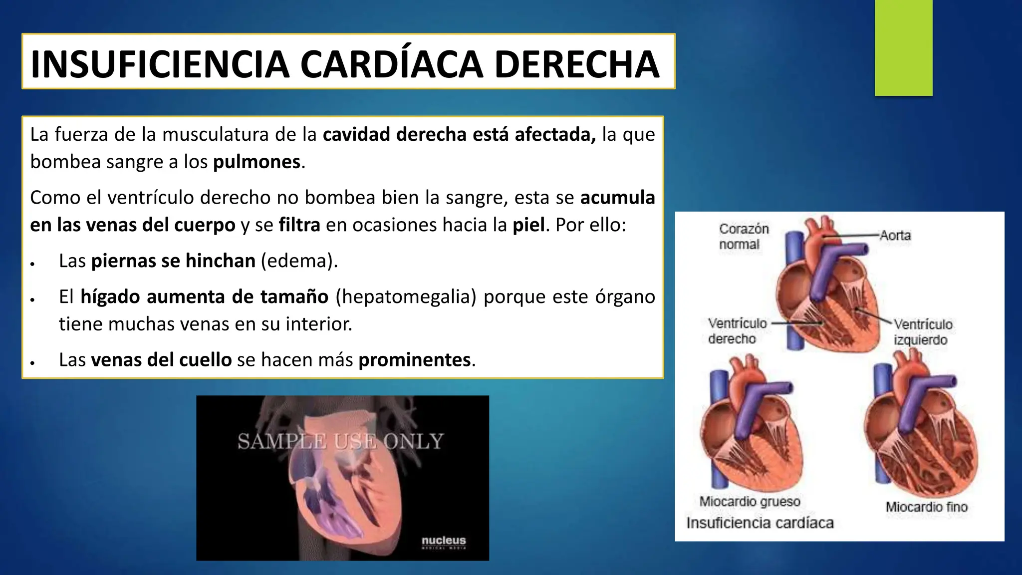 Insuficiencia cardiaca.pptx Más info record | PPT