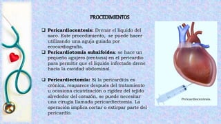 Insuficiencia Cardíaca Congestiva. / Pericarditis | PPTX