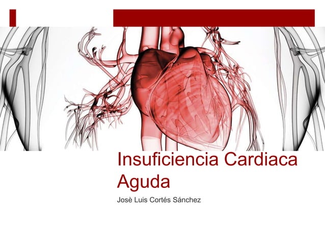 Insuficiencia cardiaca aguda. Manejo actual en urgencias. | PPT