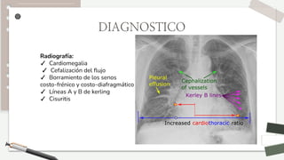 INSUFICIENCIA CARDIACA AGUDAAAAA (1).pdf