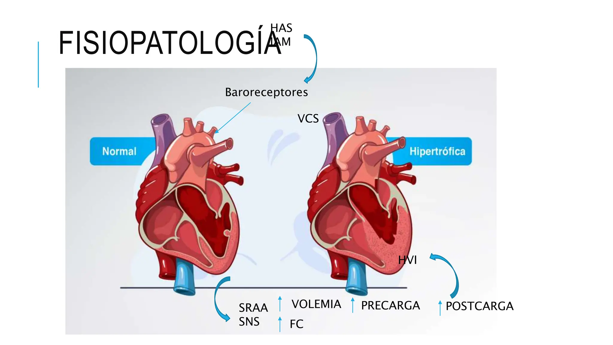 Insuficiencia cardiaca aguda y crónica.pptx