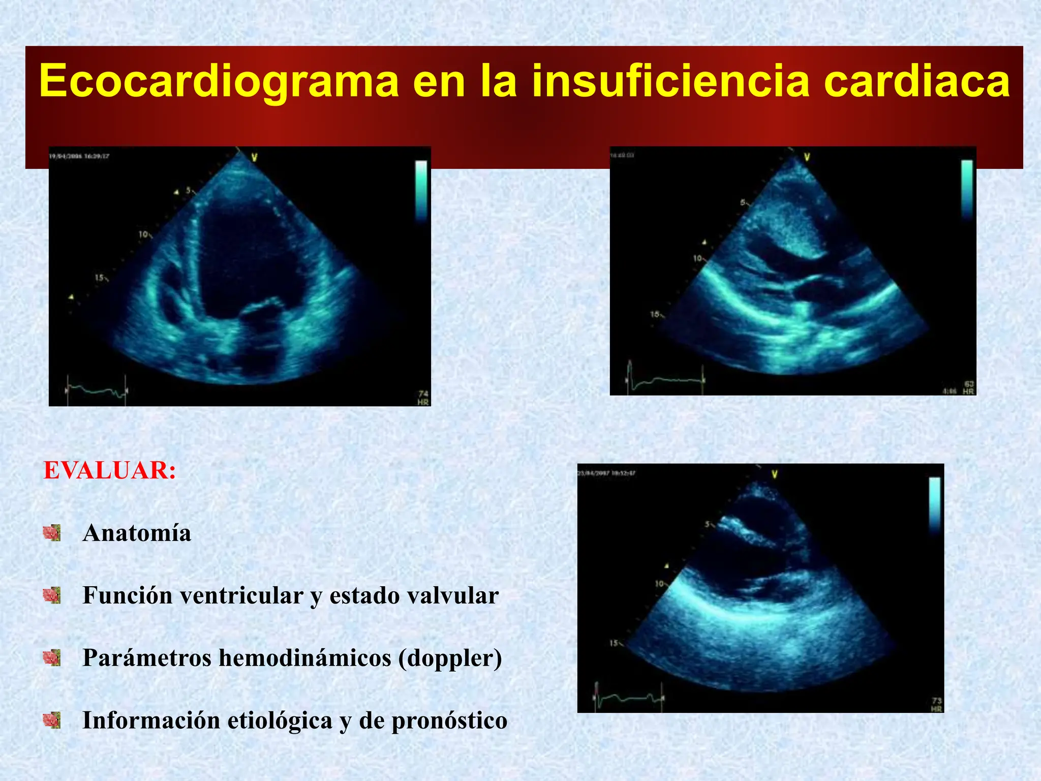 INSUFICIENCIA CARDIACA CONGESTIVA (ICC) / Falla Cardíaca | PPT