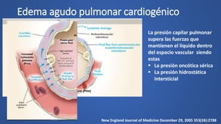 Insuficiencia cardiaca congestiva y edema pulmonar agudo | PDF