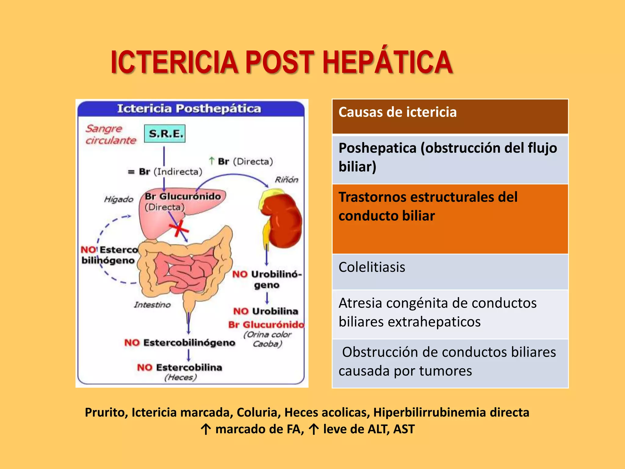 Fisiopatologia de Insuficiencia hepatica, Universidad Mayor de San ...