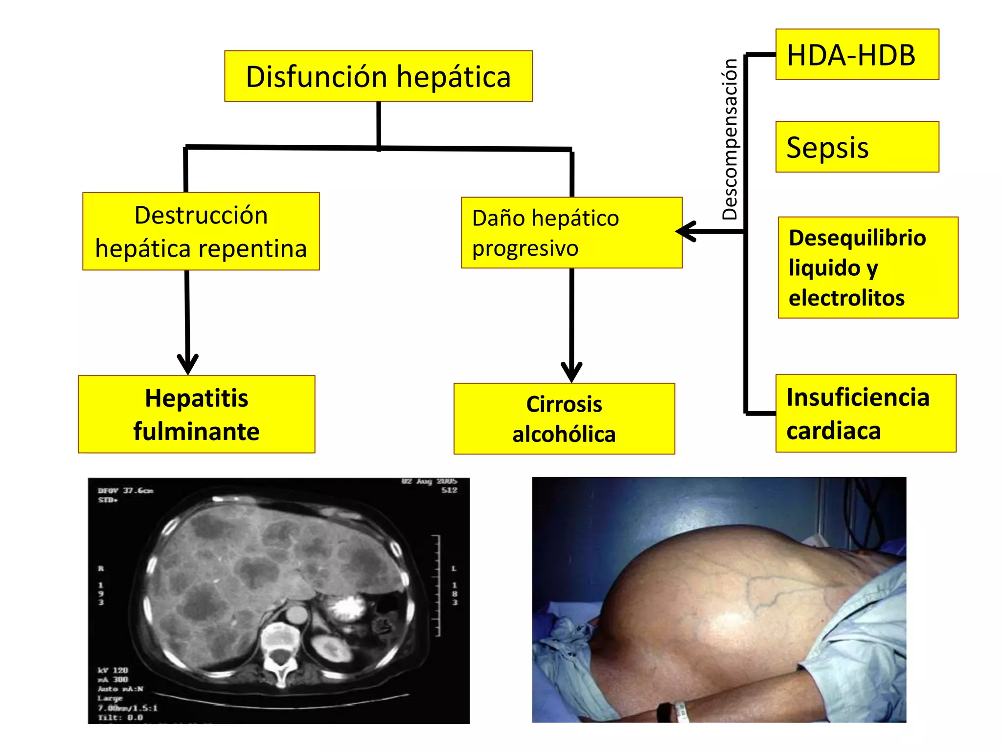 Fisiopatologia de Insuficiencia hepatica, Universidad Mayor de San ...