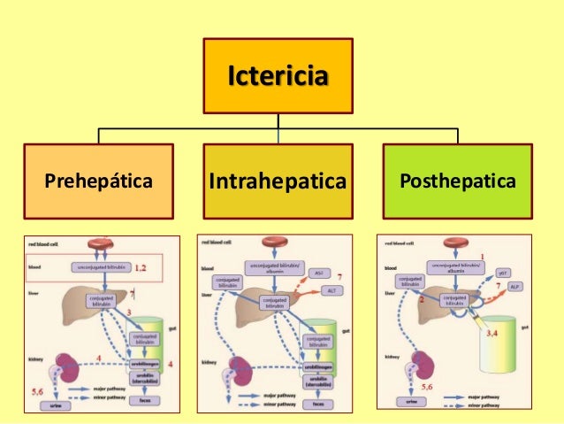 Fisiopatologia de Insuficiencia hepatica, Universidad Mayor de San Si…