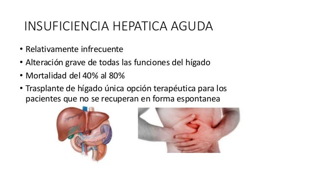 Paciente Com Insuficiencia Hepatica Aguda