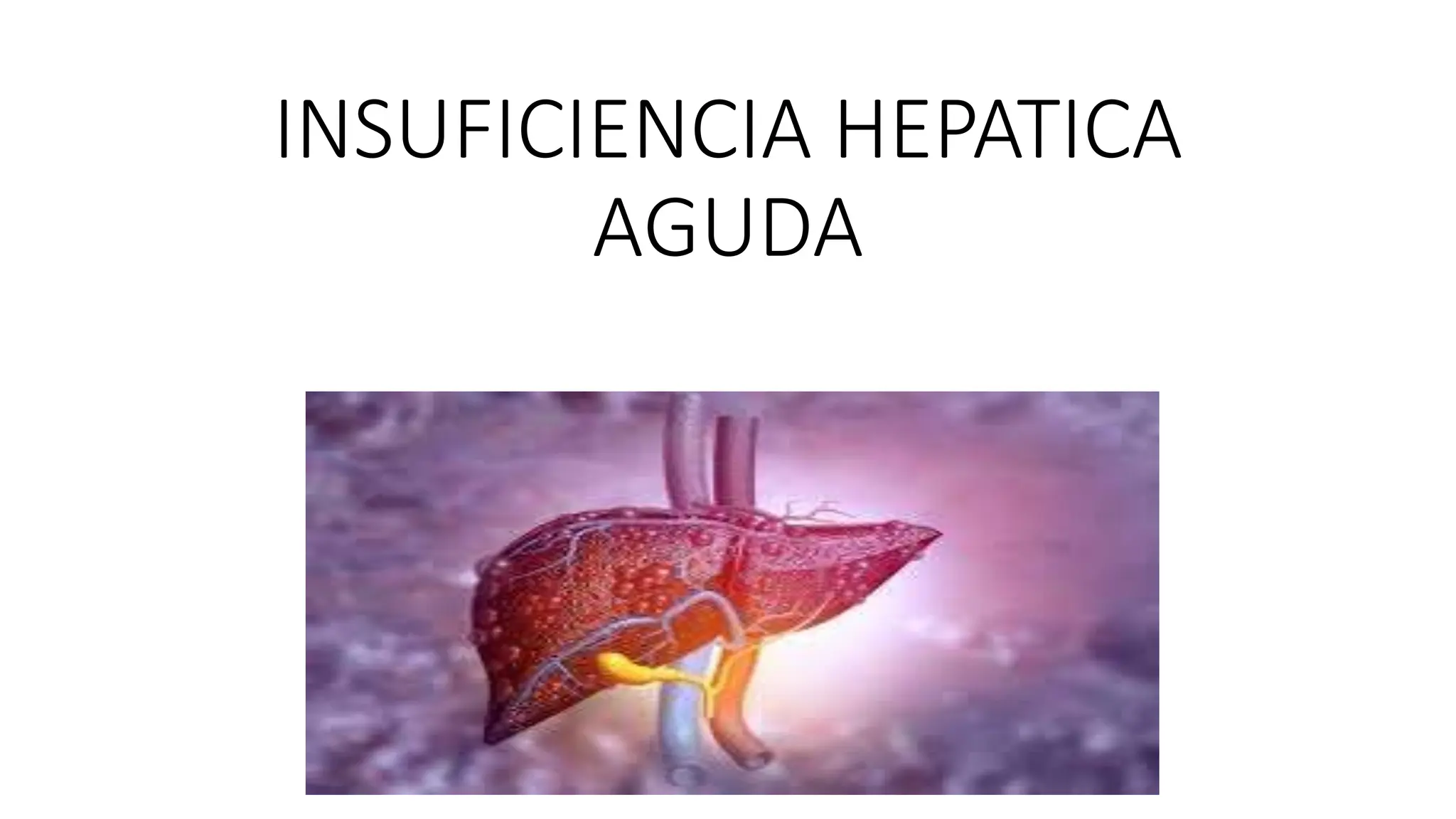 INSUFICIENCIA HEPATICA AGUDA-INSUFICIENCI | PPTX