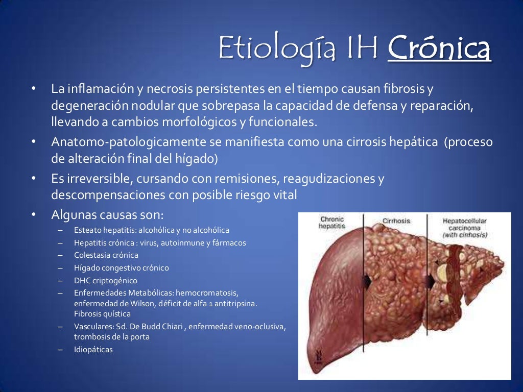 Insuficiencia hepática