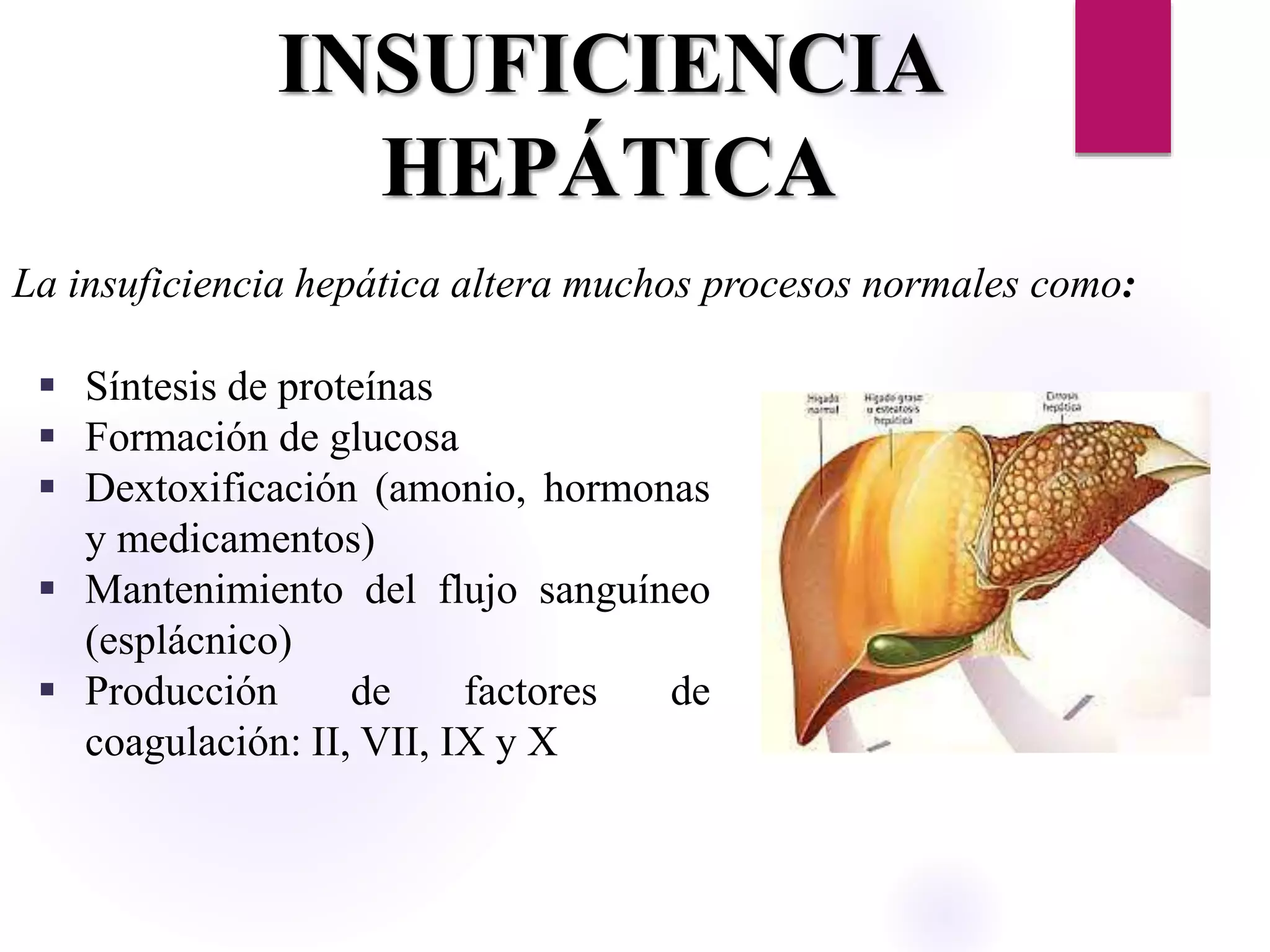 Insuficiencia Hepática | PPTX