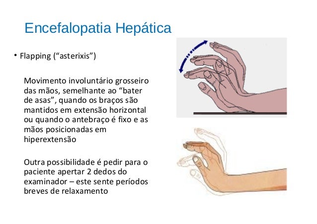 INSUFICIENCIA HEPÁTICA E HIPERTENSÃO PORTA