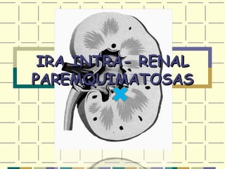 Insuficiencia renal aguda | PPT