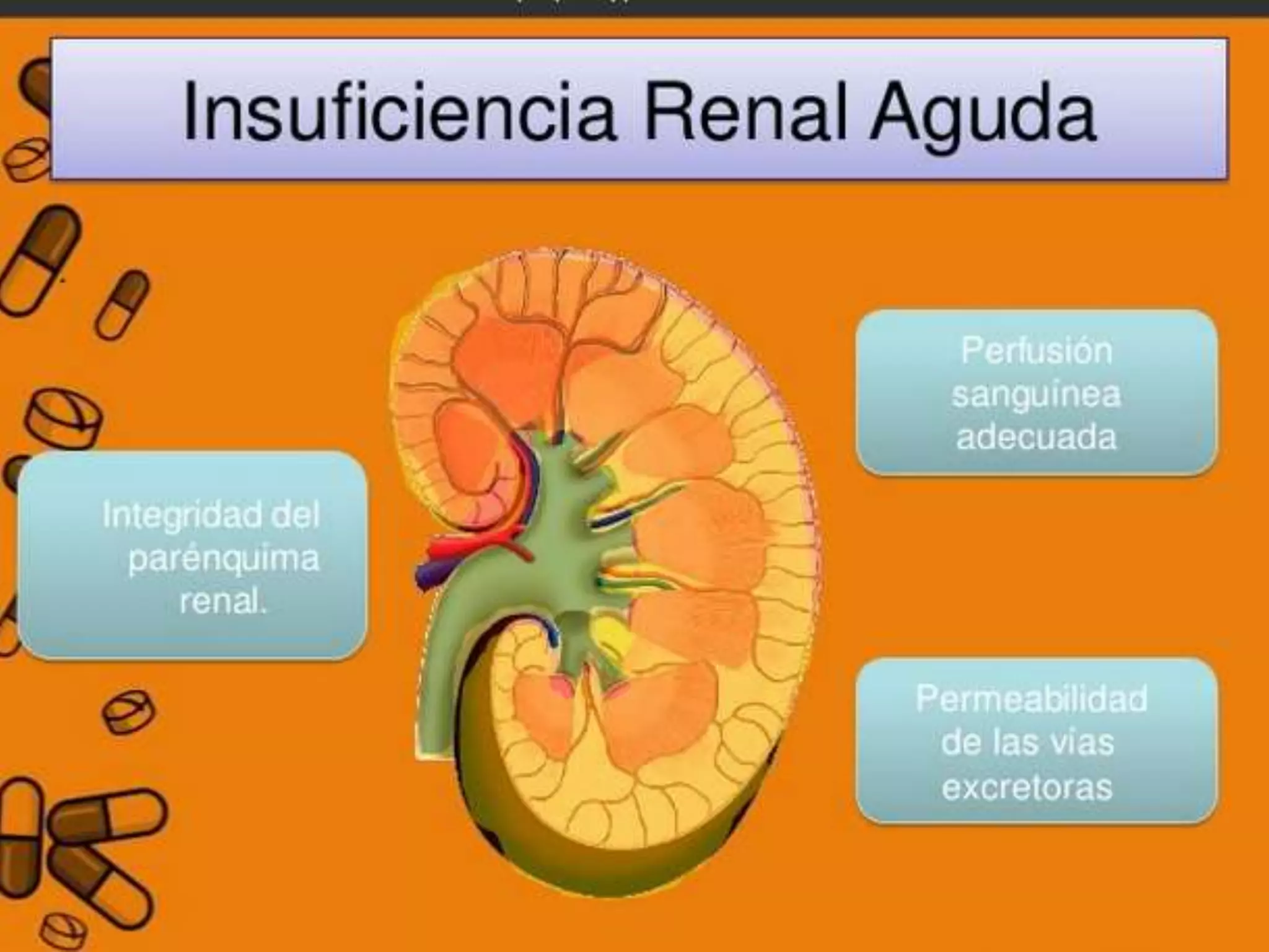 INSUFICIENCIA RENAL AGUDA.pptx