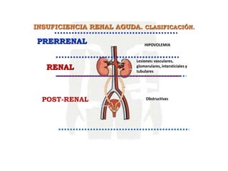 INSUFICIENCIA RENAL AGUDA.pptx