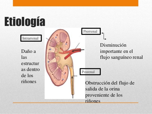 Insuficiencia renal y necrosis tubular aguda