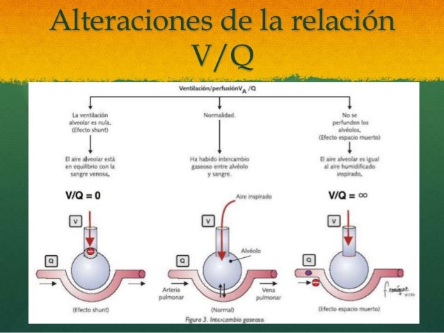 Mecanismos fisiopatológicos Insuficiencia respiratoria
