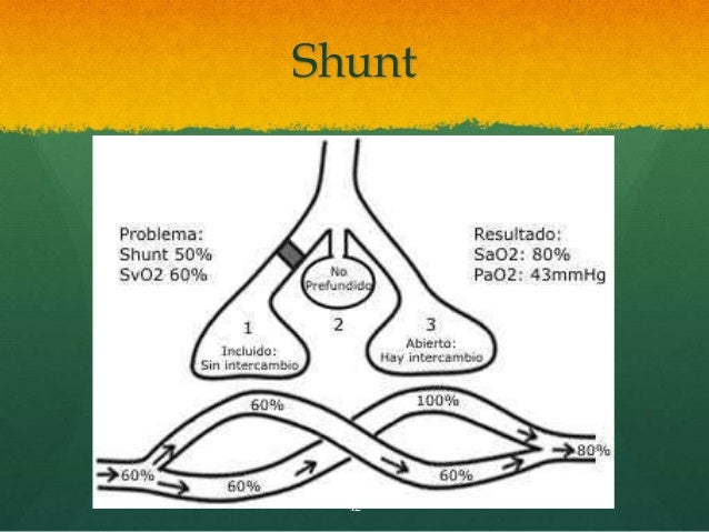 Mecanismos fisiopatológicos Insuficiencia respiratoria