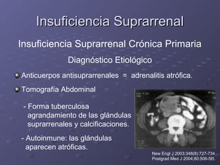 Insuficiencia suprarrenal | PPT