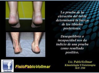 insuficiencia tibial posterior pablo vollmar.PDF