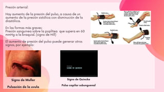 insuficiencia valvular del corazón presentación propedéutica | PDF