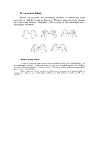 Insuficiência Velofaríngea | DOC